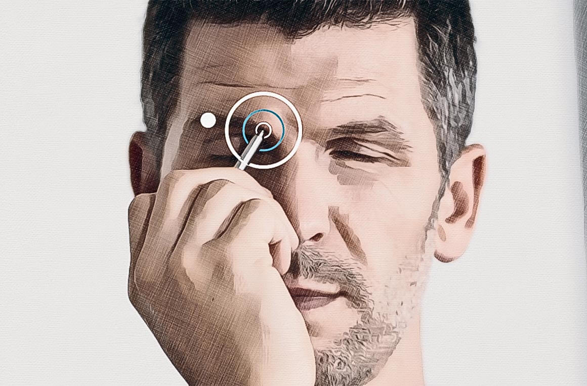 Akupunkturpunkt Bl 02 | Schnell und einfach finden