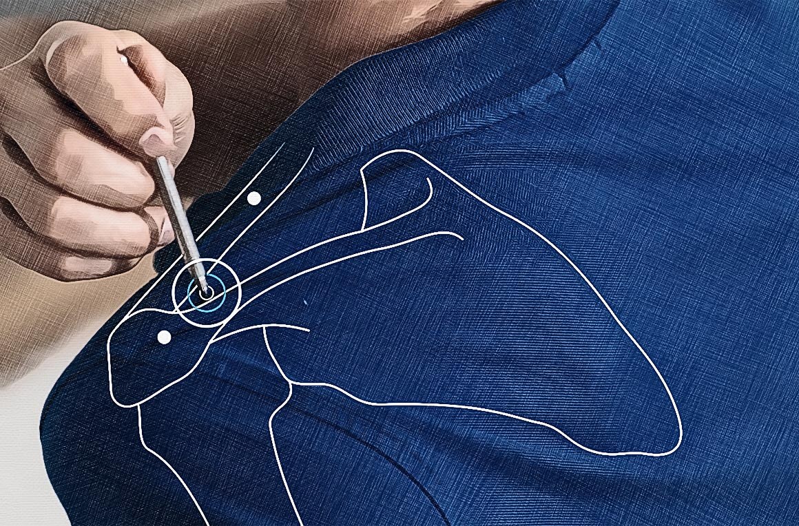 Acupuncture Atlas | Where are the most important acupuncture points?