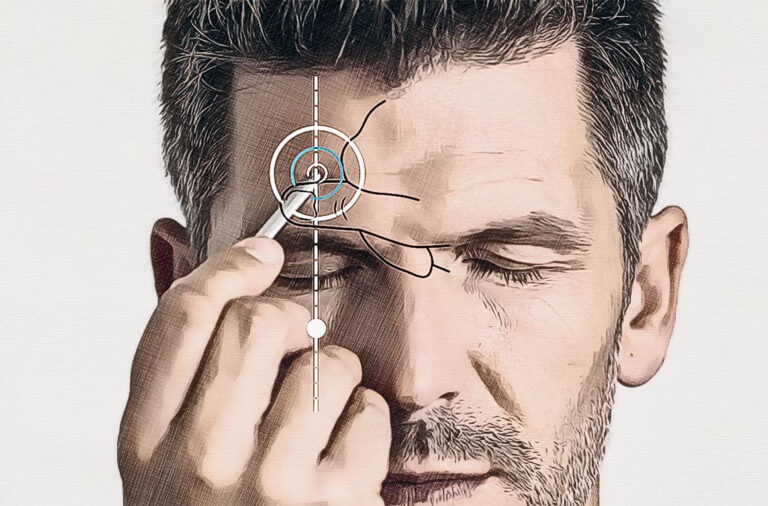 Acupuncture Atlas | Where are the most important acupuncture points?