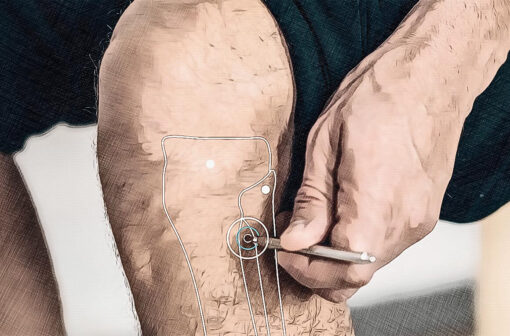 Acupuncture Point Gb 34 | Find quickly and easily