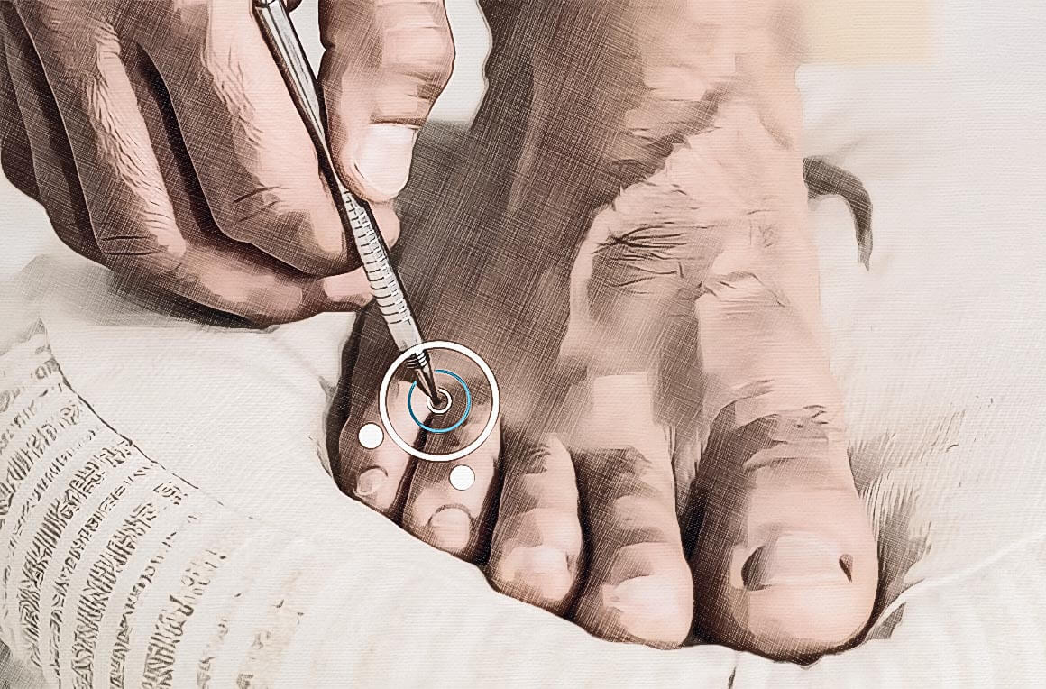 Acupuncture Atlas | Where are the most important acupuncture points?
