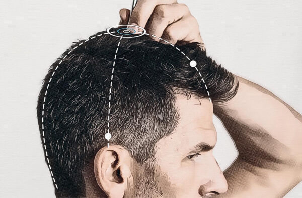 Acupuncture Point GV 20 | Find quickly and easily