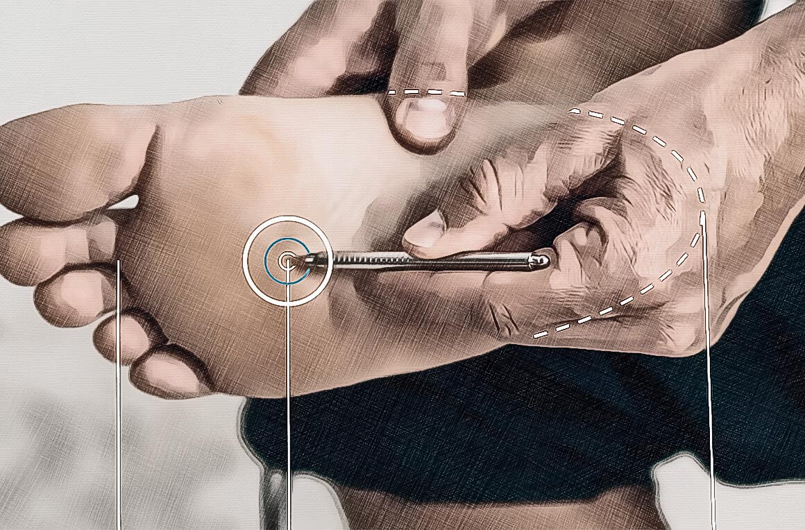 Acupuncture Atlas | Where are the most important acupuncture points?